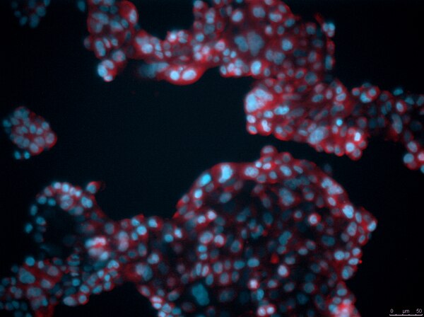 Calu-3 Human Lung Adenocarcinoma Cell Line | SCC438